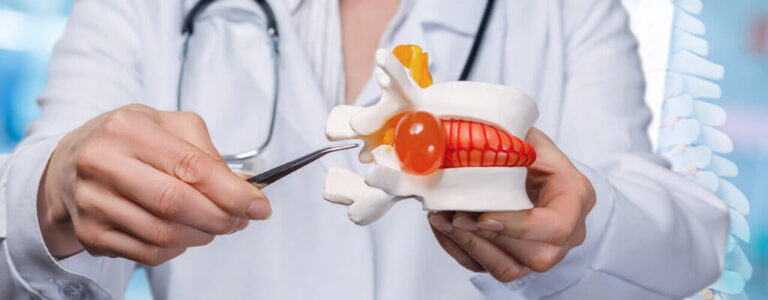 Herniated Disc/Bulging Disc/Ruptured Disc/Slipped Disc