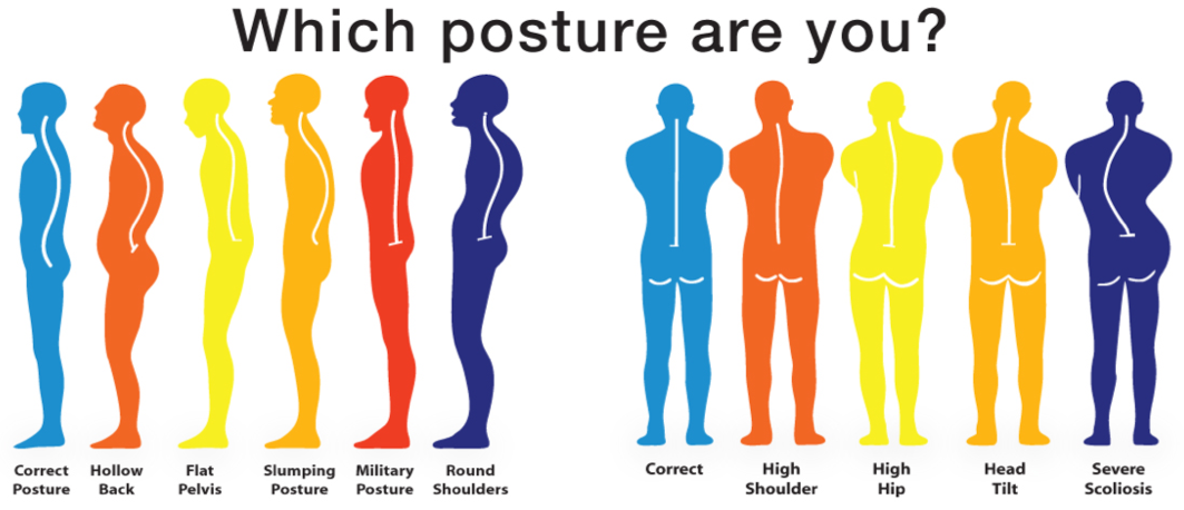 Look and Feel Better By Having Your Posture Corrected